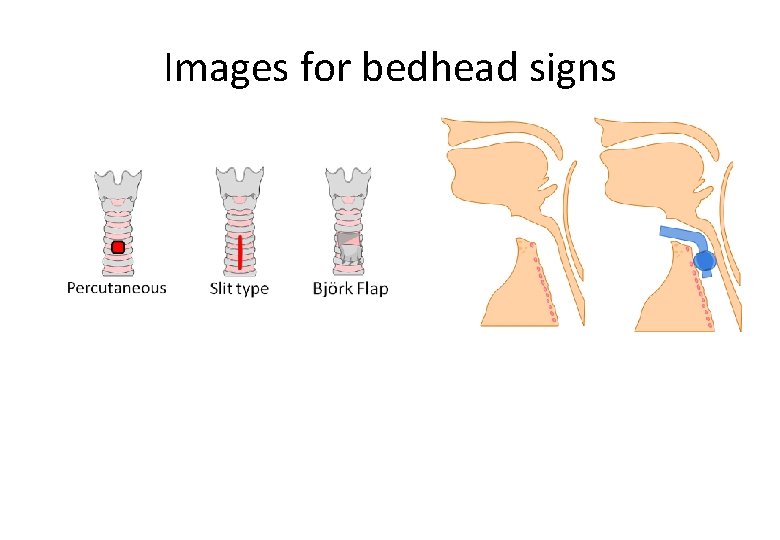 Bed head signs These Power Point slides are