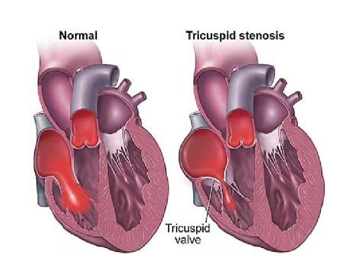 HEART COR Atrium Ventriculus Septum interatriale Septum interventriculare