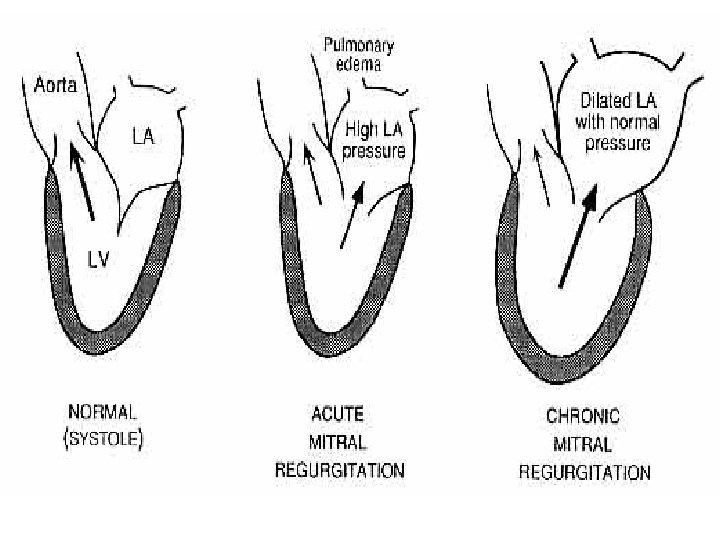 HEART COR Atrium Ventriculus Septum interatriale Septum interventriculare