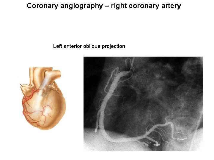 HEART COR Atrium Ventriculus Septum interatriale Septum interventriculare