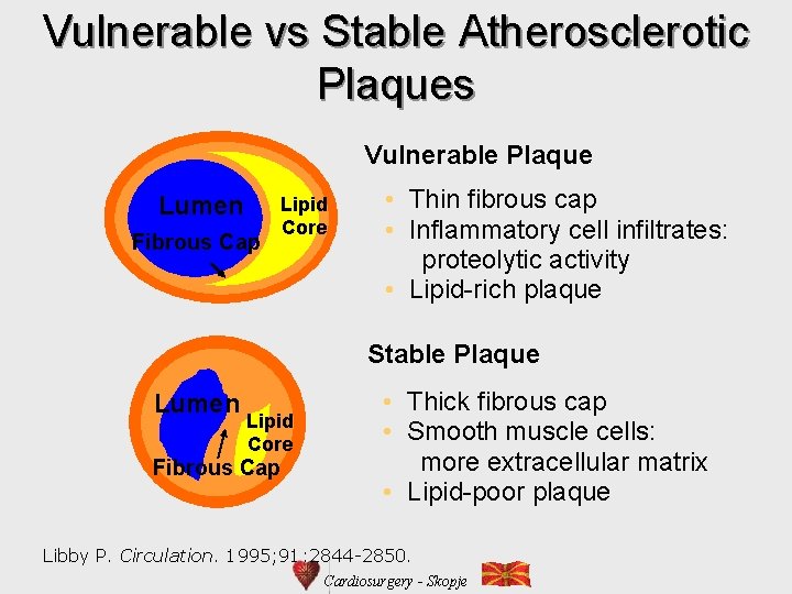 Differential diagnosis and treatment of acute coronary disease
