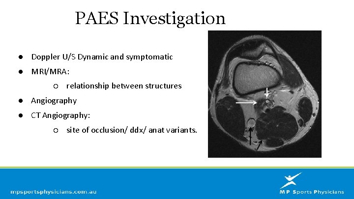 Anatomical Variants of the lower limb Shank Pain