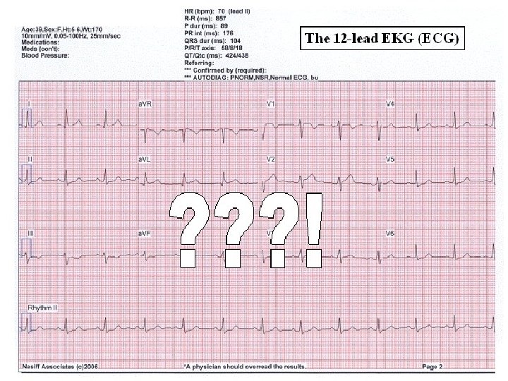 A brief introduction to the standard 12 lead