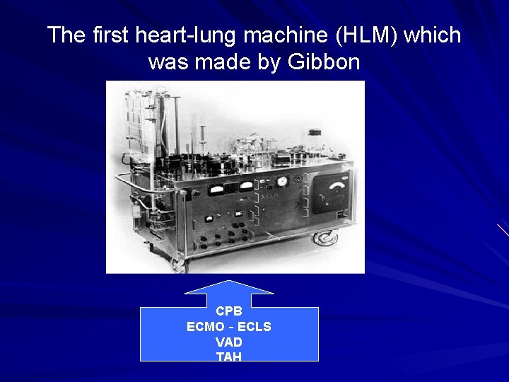 Pediatric extracorporeal life support systems and Pediatric cardiopulmonary