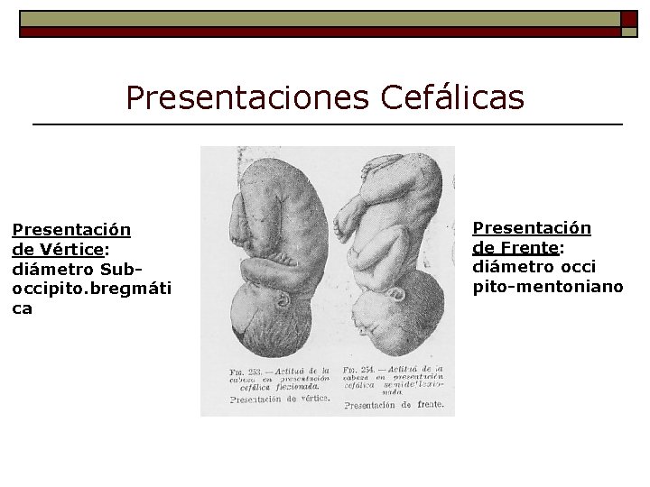 EL PARTO GENERALIDADES Mara Teresa Cardemil J Inst