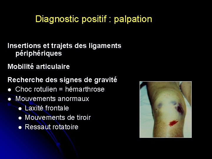 Entorse et luxation de genou Epidmiologie l l