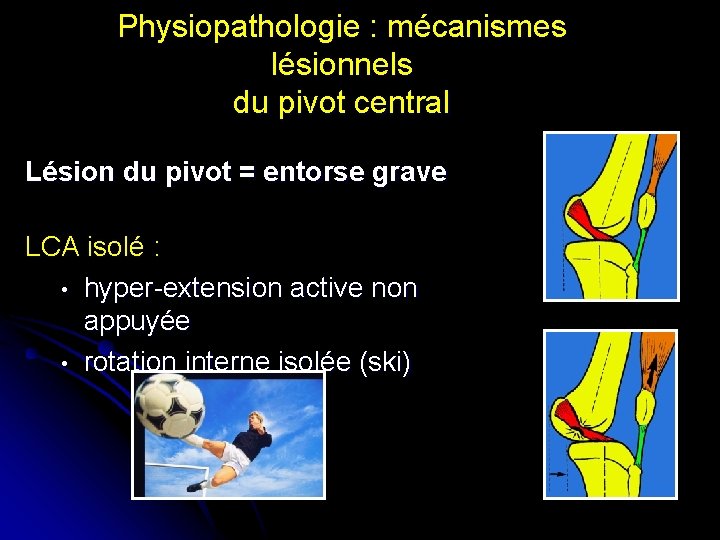 Entorse et luxation de genou Epidmiologie l l