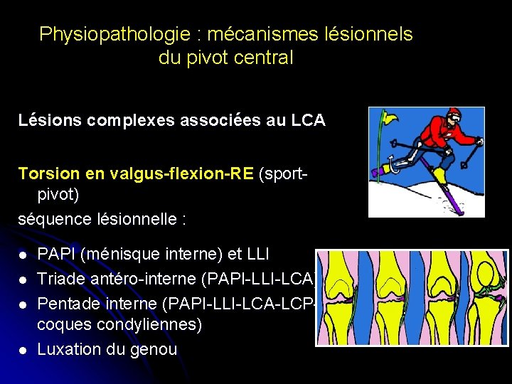 Entorse et luxation de genou Epidmiologie l l
