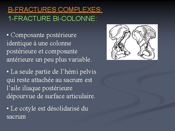 LES FRACTURES DU COTYLE CE QUATTEND LE CHIRURGIEN