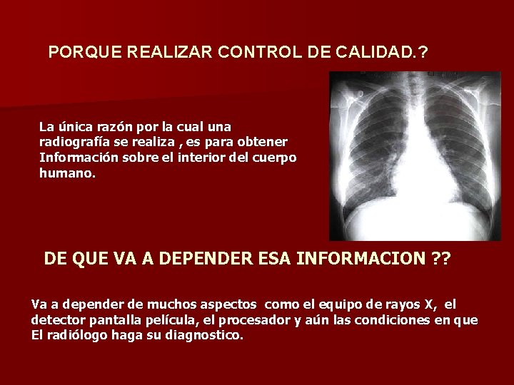 CONTROL DE CALIDAD EN RADIOLOGIA M o t