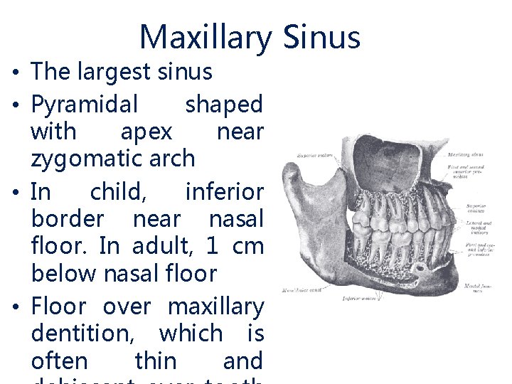 Acute Sinusitis Anatomy of PNS A QUICK RECAP