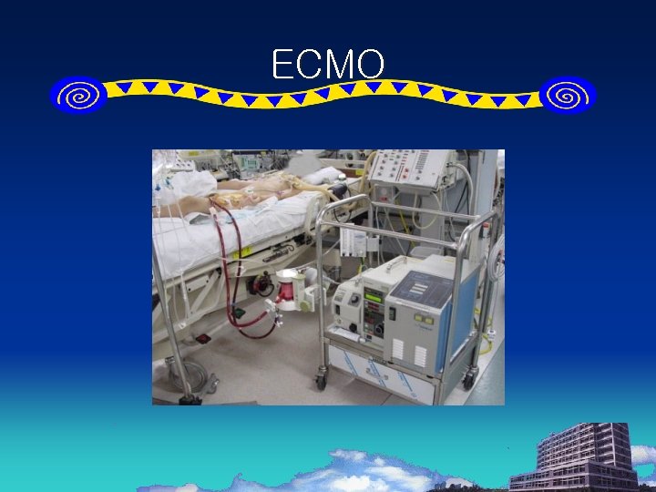 ECMO Extra Corporeal Membrane Oxygenator 2007 9 18