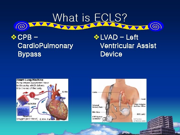 ECMO Extra Corporeal Membrane Oxygenator 2007 9 18