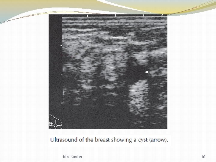 The Breast Learning Objectives Appropriate investigation of breast