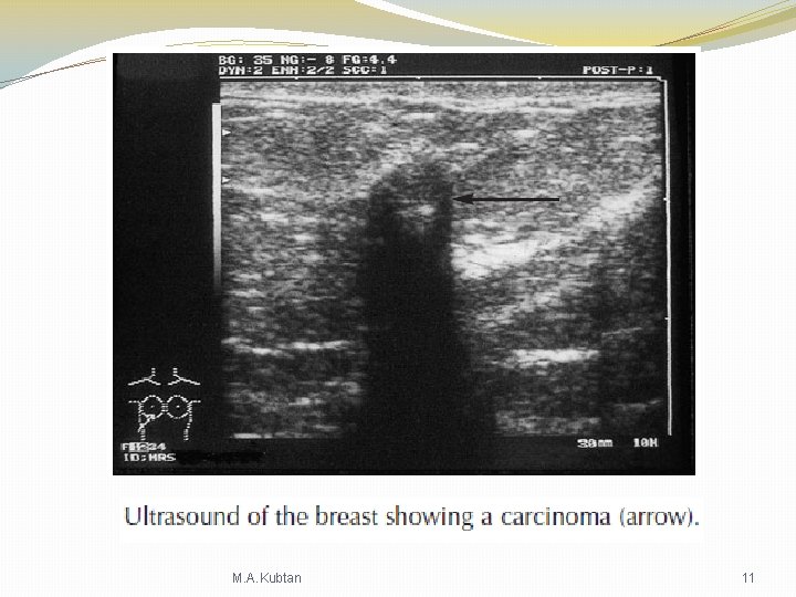 The Breast Learning Objectives Appropriate investigation of breast