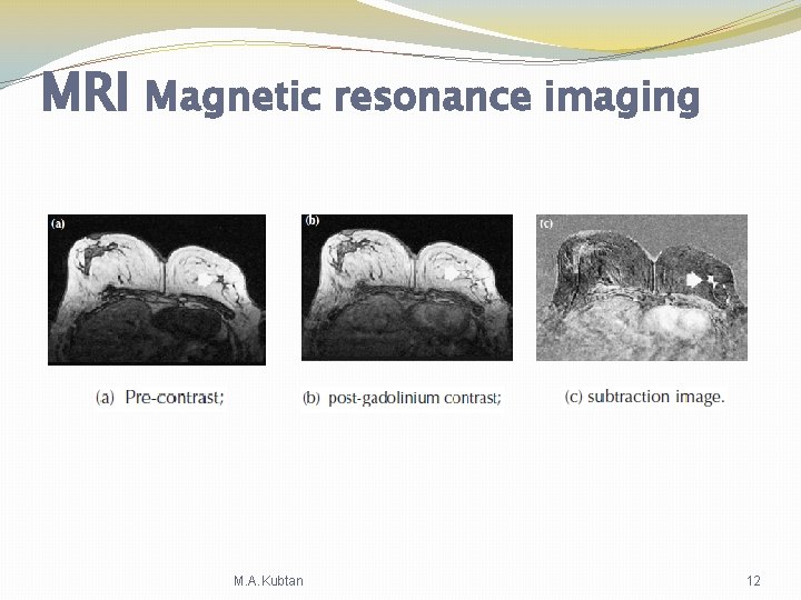 The Breast Learning Objectives Appropriate investigation of breast