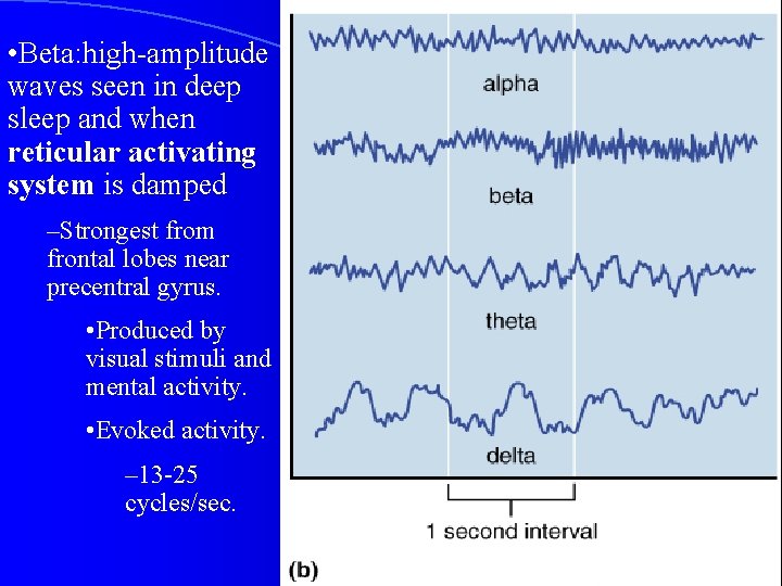 Section 6 Electroencephalogram EEG Wakefulness and Sleep I