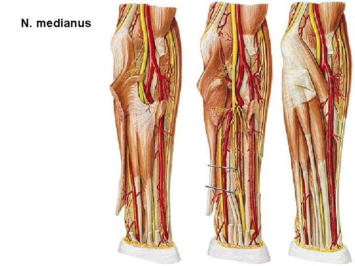 PLEXUS BRACHIALIS PARS SUPRACLAVICULARIS PARS INFRACLAVICULARIS PARS ...