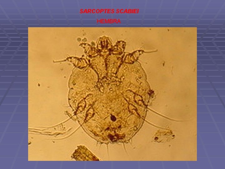 SARCOPTES SCABIEI var HOMINIS Sarna sarcptica escabiosis roa
