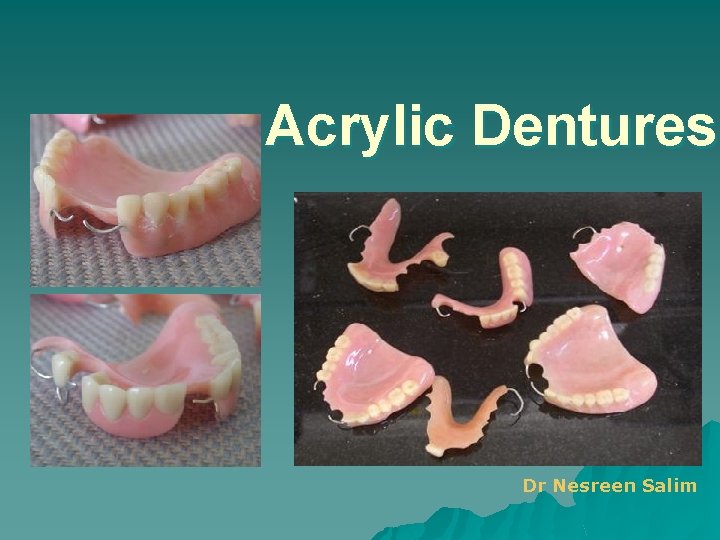Acrylic Dentures Dr Nesreen Salim CoCr Partial denture