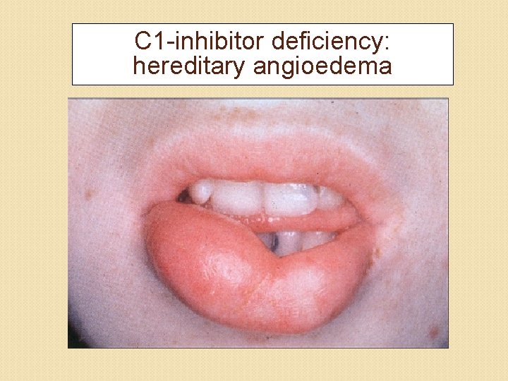 Proteins of the complement system nomenclature C 1qrs