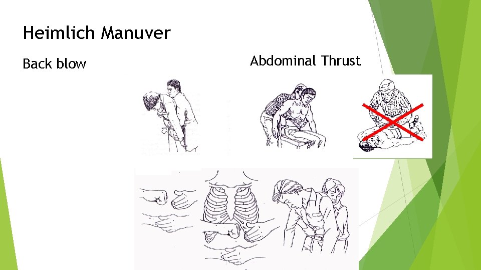 Airway Breathing Management Ns Mokhtar Jamil M Kep