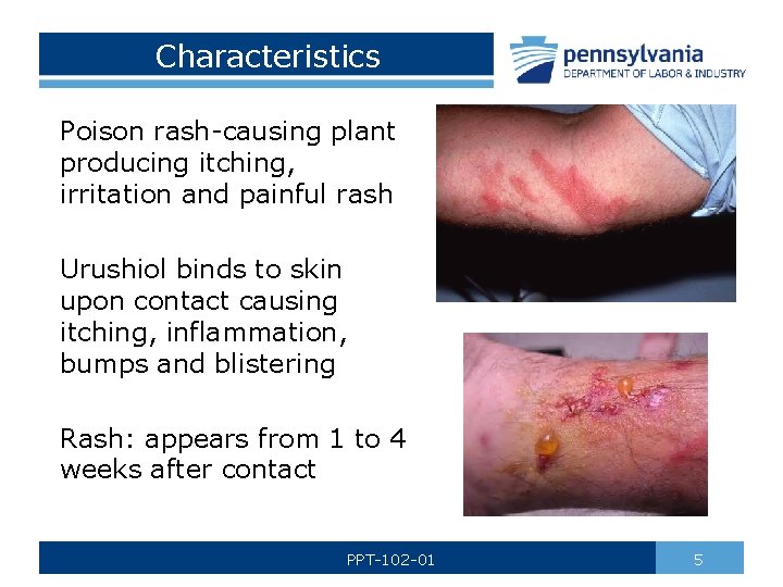 Poison Ivy Awareness Bureau of Workers Compensation PA