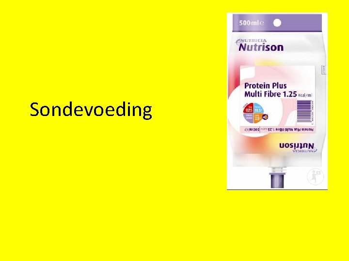 Sondevoeding Wat is sondevoeding Vloeibare voeding die geven