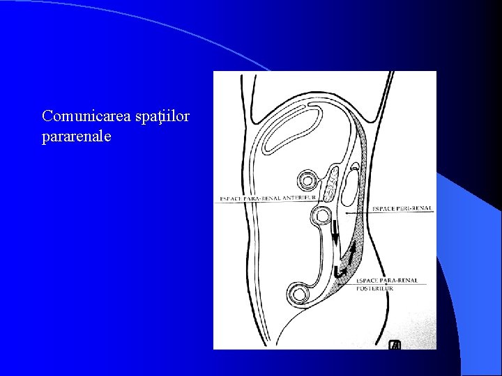 Spaiul retroperitoneal anatomie imagistic Spaiul retroperitoneal l Limite