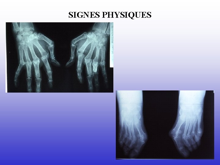 SOINS INFIRMIERS EN RHUMATOLOGIE PRESENTATION DU SERVICE DE