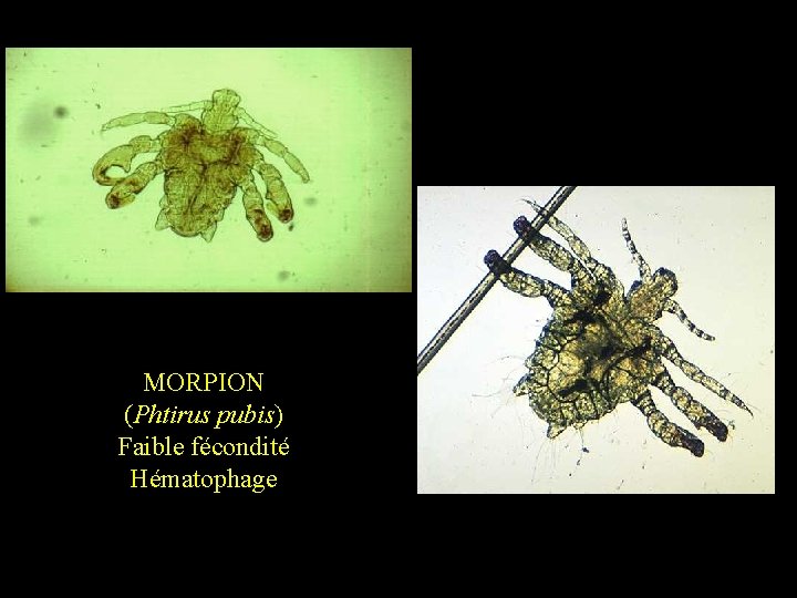 ECTOPARASITES ARTHROPODES INSECTES ACARIENS INSECTES 3 paires de