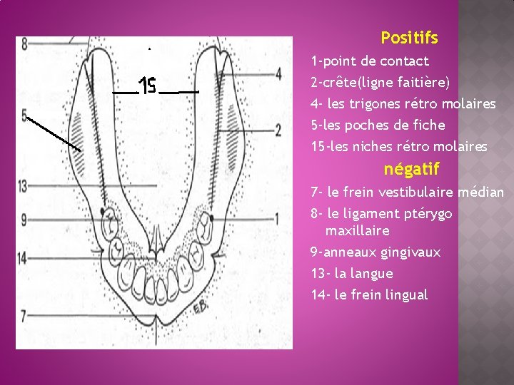 DEPARTEMENT DE CHIRURGIE DENTAIRE SERVICE DE PROTHESE COURS