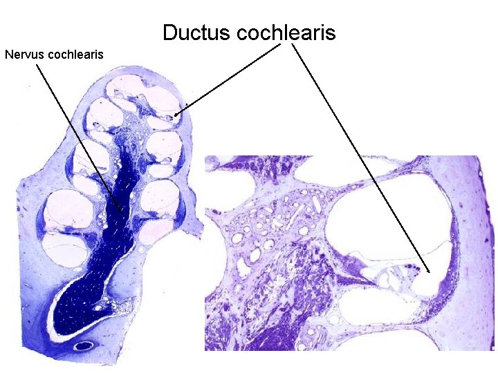 Organum vestibulocochleare Inneres Ohr Corti Organ und Hrbahn