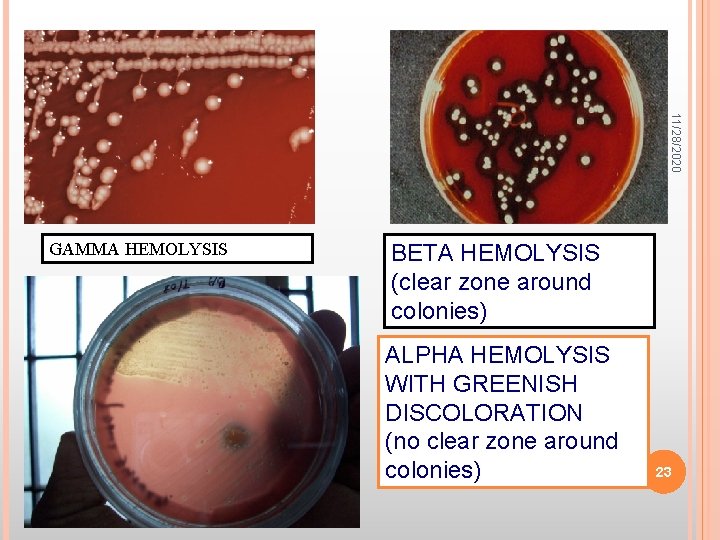 11282020 CULTURE MEDIA 1 Bacteria 11282020 have to