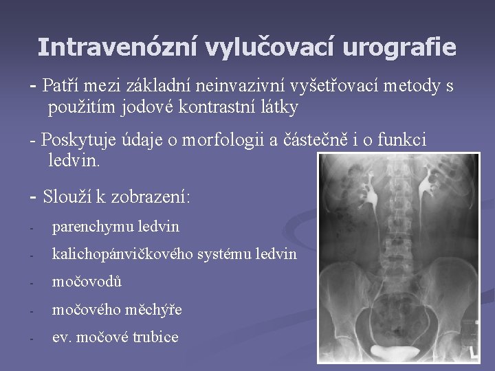 Rentgenov kontrastn zobrazovac metody v uroradiologii MUDr Iva