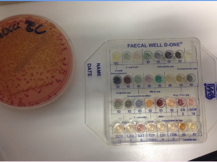 FECAL WELL DONE INTESTINAL INFECTIONS DEFINITION Intestinal infections