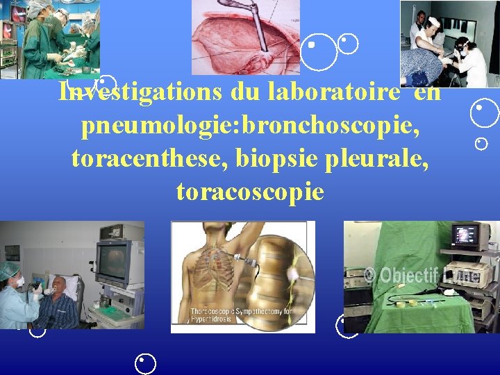 Investigations du laboratoire en pneumologie bronchoscopie toracenthese ...