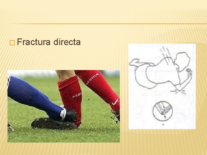 ZLOMENINY FRACTURAE Barbora Tomov Tereza Vanurov 17 sk