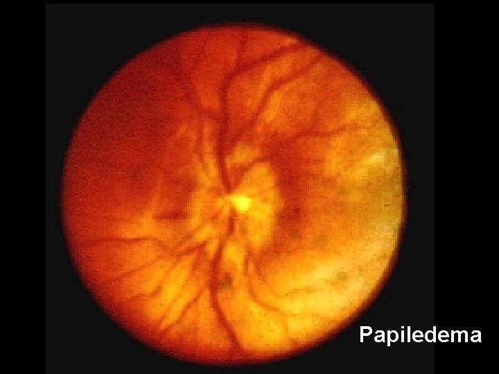 EXAMEN DEL FONDO DE OJO Exploracin bsica fundamental