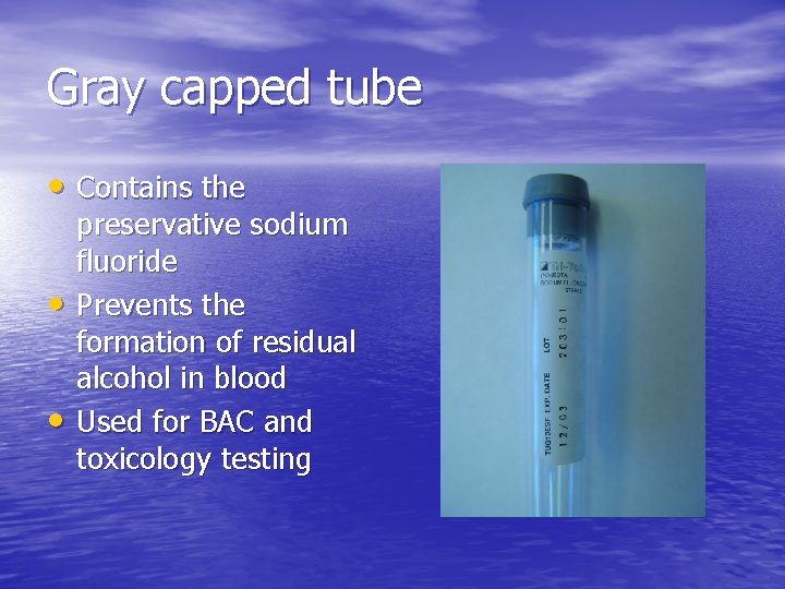 Forensic Serology Blood and other body fluids Golden