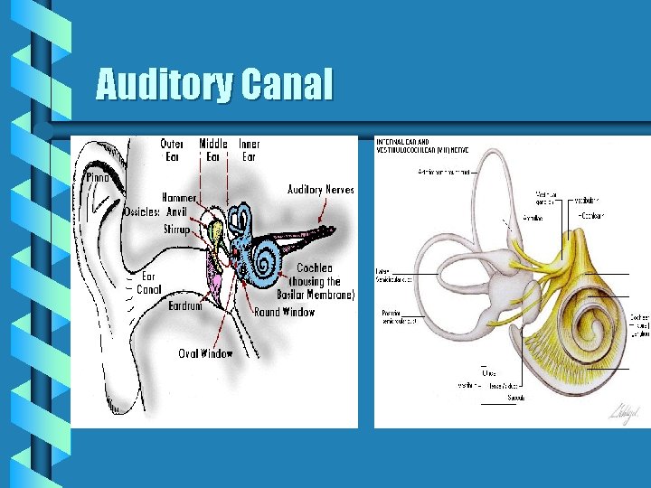 Cranial Nerve Lesion Acoustic Neuroma Presented By Emma