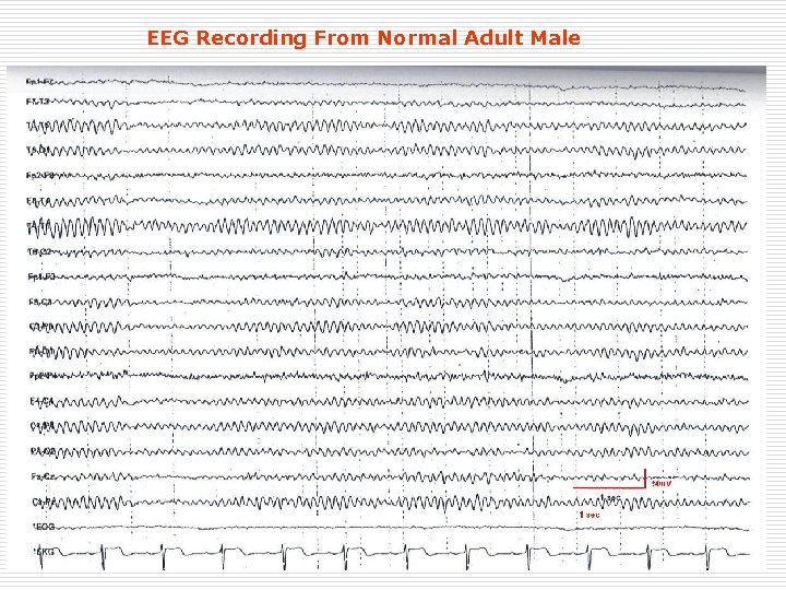 ELECTROENCEPHALOGRAPHY EEG Dr Shaikh Mujeeb Ahmed M B