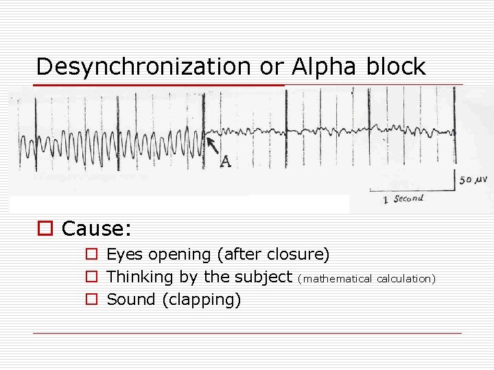 ELECTROENCEPHALOGRAPHY EEG Dr Shaikh Mujeeb Ahmed M B