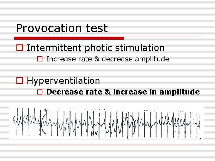 ELECTROENCEPHALOGRAPHY EEG Dr Shaikh Mujeeb Ahmed M B