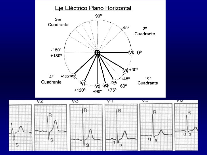 ELECTROCARDIOGRAFIA Prof Dr Juan Ricardo Corts Electrocardiograma Registro