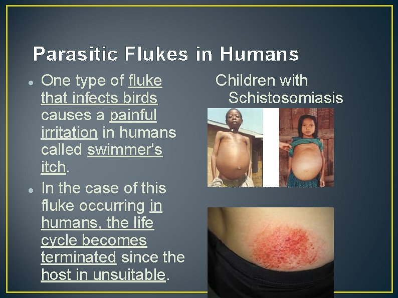 Phylum Platyhelminthes and other Acoelomate Animals Chapter 8