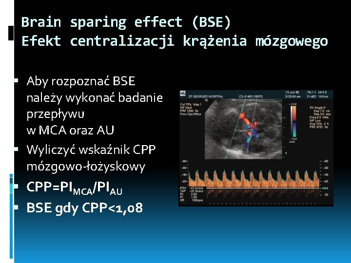 Klinika Perinatologii i Ginekologii HIPOTROFIA PODU HIPOTROFIA PODU