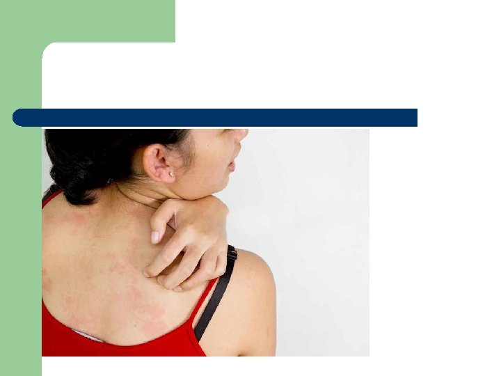 Ghid de diagnostic si tratament in Mastocitoza Cuprins