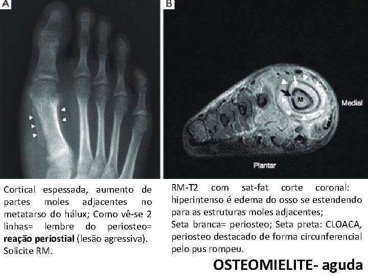 Doenas do Sistema Osteomuscular 2 Mais jovem Idade