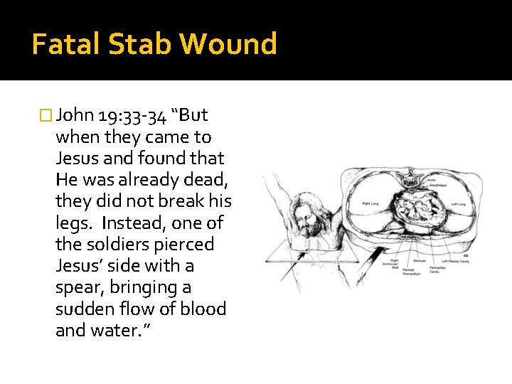 How Did Jesus Die The Medicine Behind Jesus